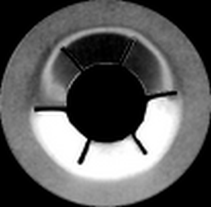 Push Nuts Stainless Steel – Mister Stainless